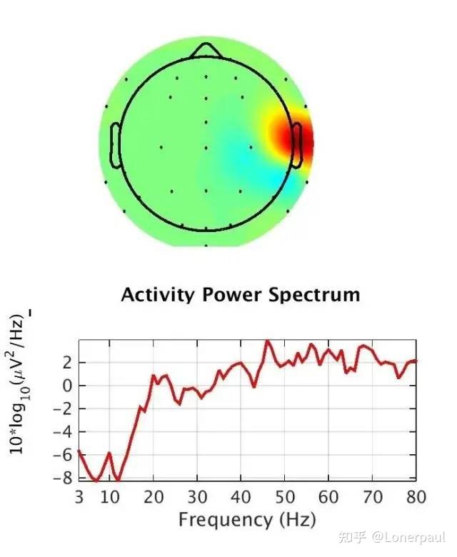 『脑电数据处理』独立成分分析法（ICA）去除脑电噪声 - 知乎