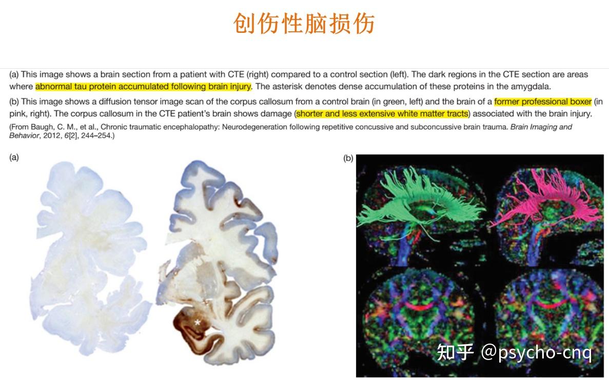 神经功能失调 (Neurological Disorders) - 知乎