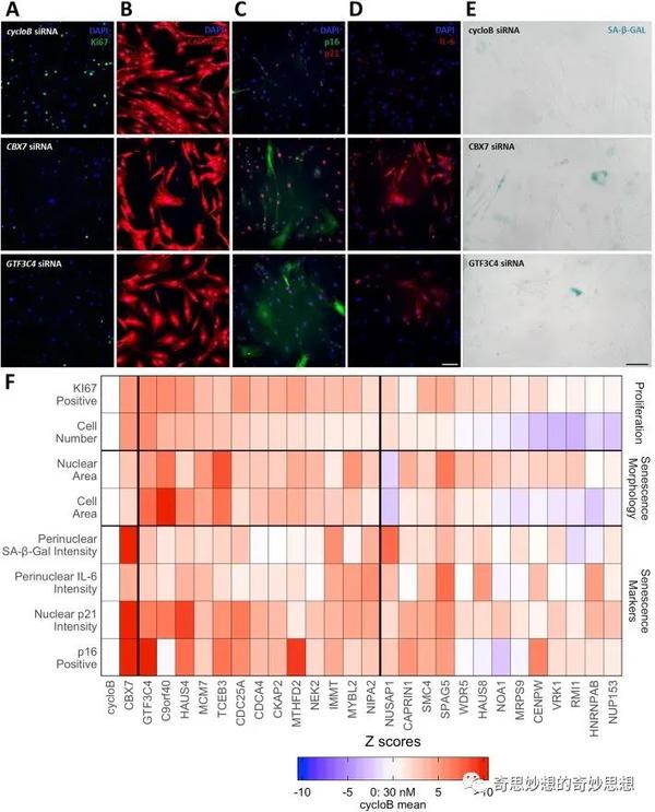 细胞衰老基因CellAge数据库对比其他衰老数据库 - 知乎
