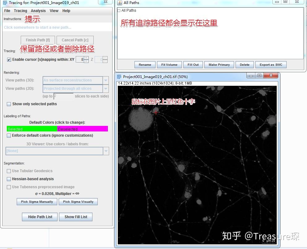 ImageJ实用技巧——Simple Neurite Tracer(插件篇) - 知乎