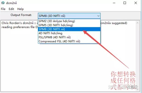 基于SPM的多模态神经影像配准方法 - 知乎