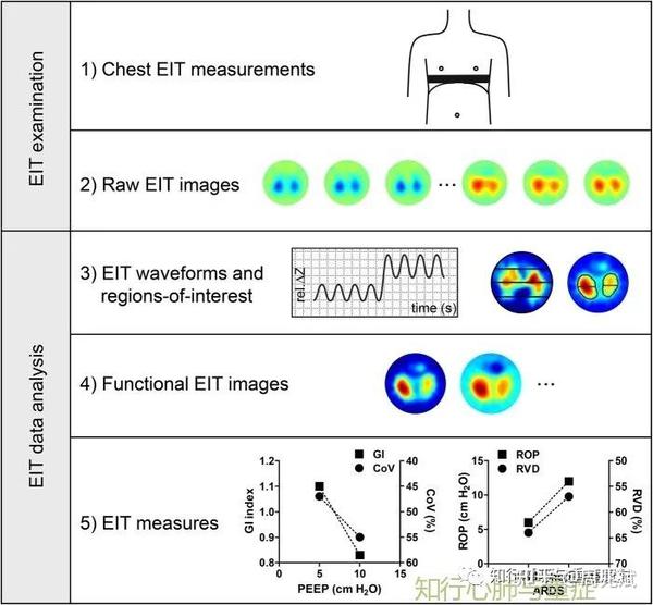 第139期胸部电阻抗断层成像（EIT）的原理、图像分析及临床应用 - 知乎