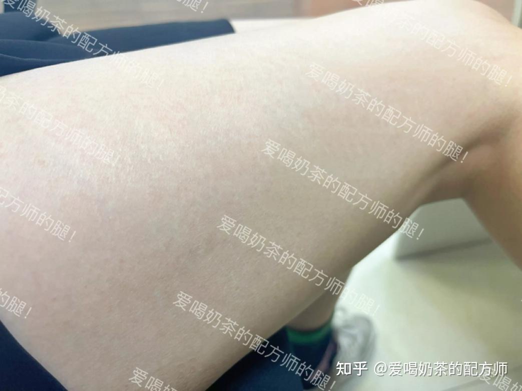 为什么老爸测评推荐的精华油这么多人买?它淡化肥胖纹真的这么猛吗? 知乎