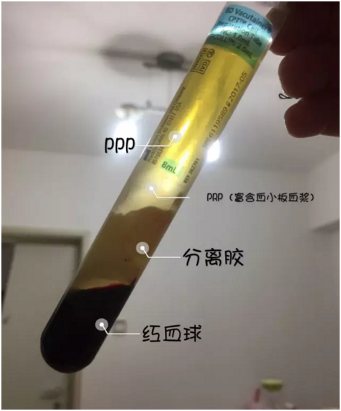 什么是PRP?是什么作用原理？有什么功效？ - 知乎