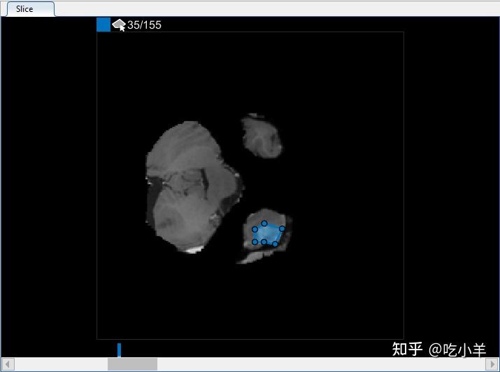 MATLAB图像处理：90：使用 Volume Segmenter 创建二进制蒙版 - 知乎