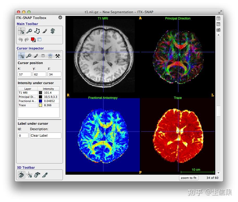 都快2024年了，还有人不知道影像组学？影像组学入门-Pyradiomics提取影像特征！ - 知乎