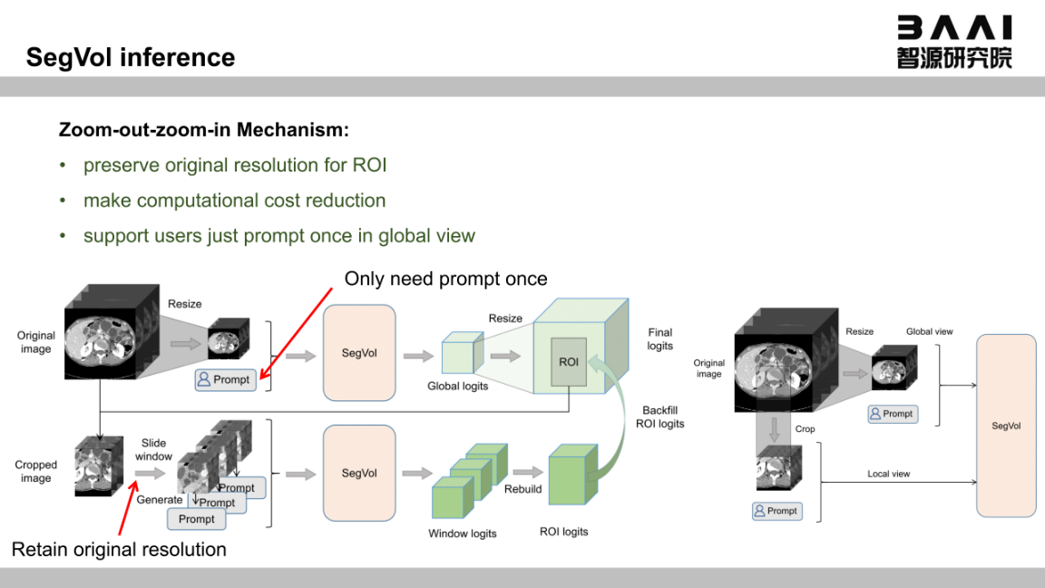 SegVol Web Tool已上线！无需配置，分割一切CT器官、组织 - 知乎
