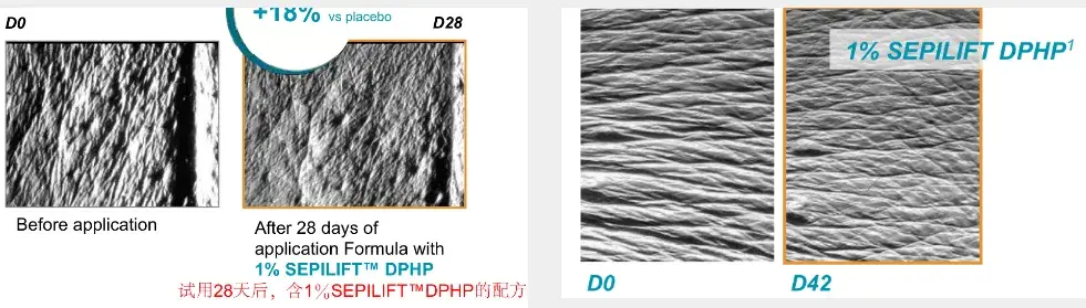 国际原料巨头⑧--Seppic赛比克，聚合物和乳化剂领导者 - 知乎