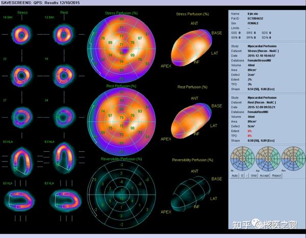 “万能核素”——锝-99m，在核医学中的应用 - 知乎