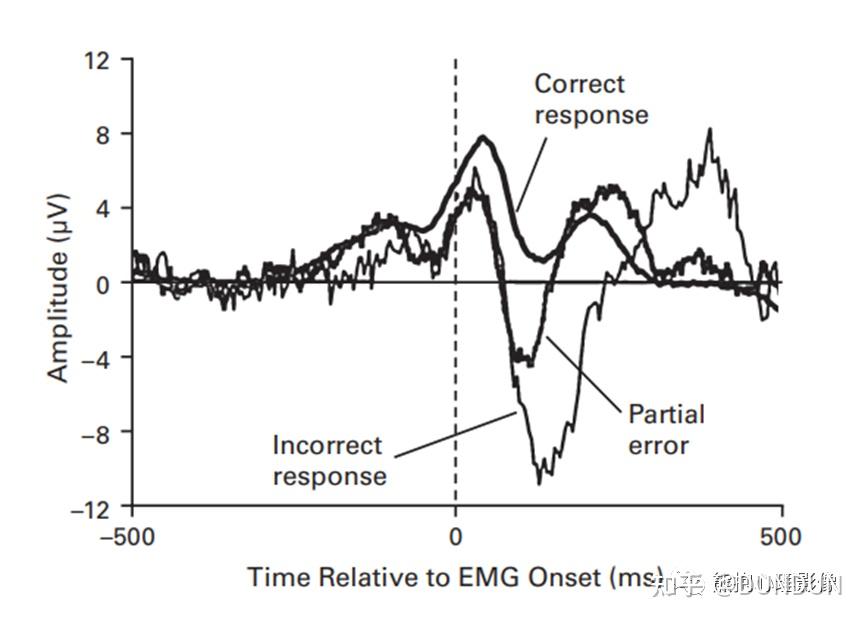 错误相关负成分-ERN成分 - 知乎