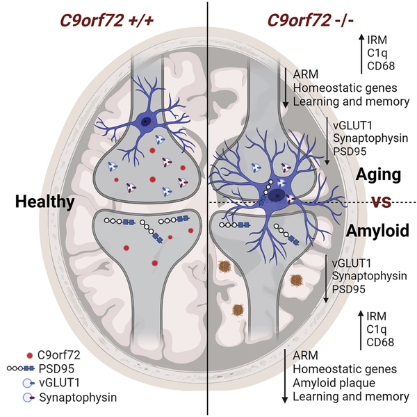 Neuron：C9orf72缺失促进小胶质细胞介导的衰老和淀粉样蛋白积累过程中的突触丧失 - 知乎