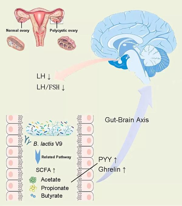 科拓研发 | 乳双歧杆菌V9对多囊卵巢综合征（PCOS）的影响 - 知乎