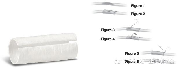 盘点外周神经系统修复相关公司及其产品 - 知乎