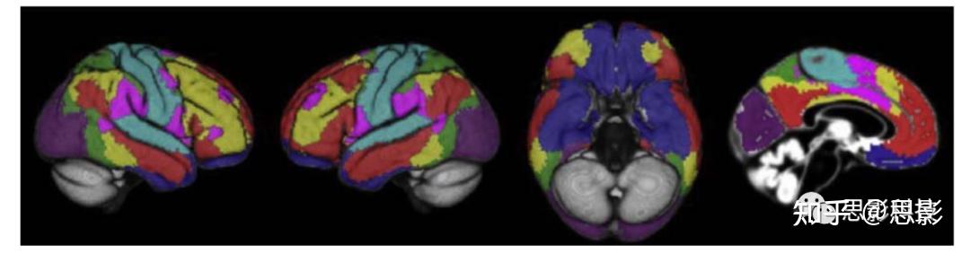 阿尔茨海默病神经影像学计划的最新出版物：改进的AD临床试验的进展综述 - 知乎