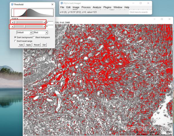 如何使用image j 分析Masson染色中的胶原蛋白含量 - 知乎