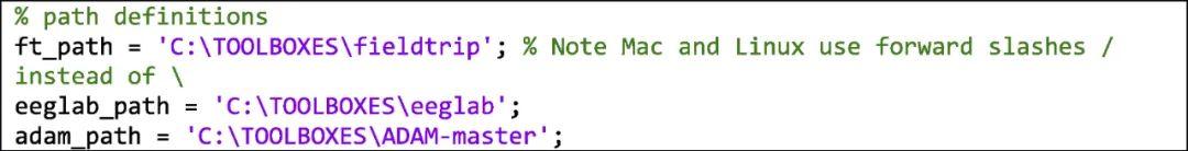 基于Matlab进行EEG-Decoding分析实用教程 - 知乎