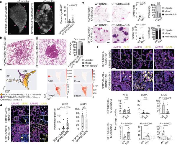 Nature重磅！揭秘KRAS（G12D）驱动鳞状肺腺癌新机制！！ - 知乎