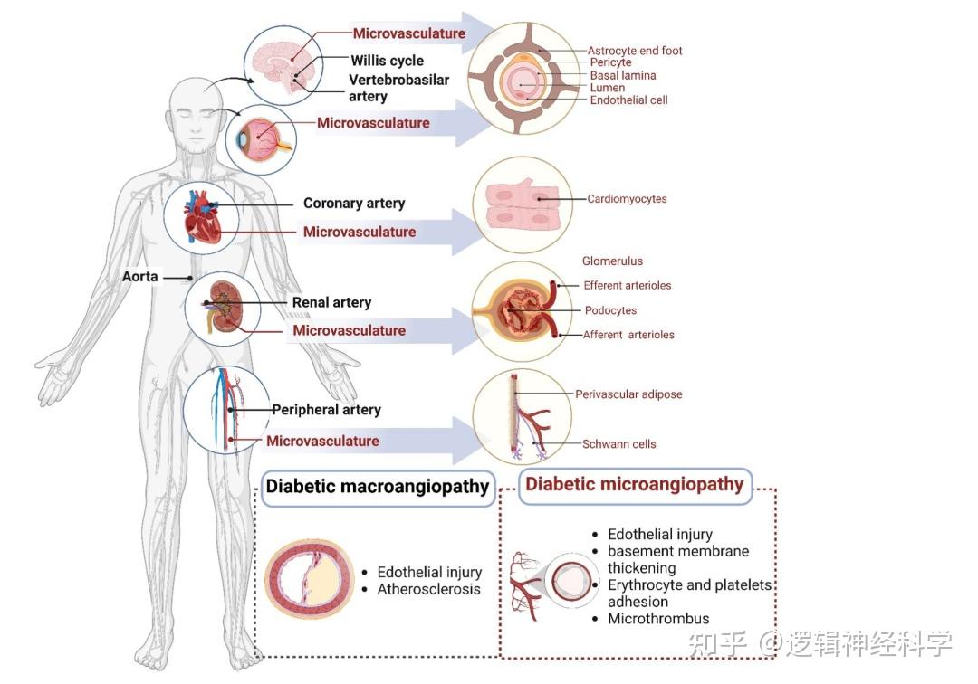 STTT 综述︱中国中医科学院刘玥团队：糖尿病泛血管病变的分子机制与治疗策略 - 知乎