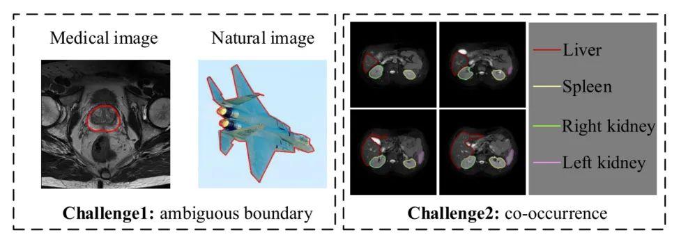 CNN 可视化：从 CVPR22 的出发，聊聊CAM是如何激活我们文章的热度 - 知乎