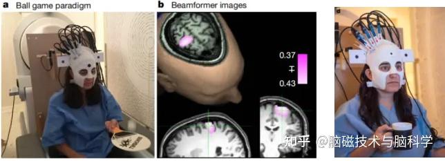 心有灵犀，脑有所应 | OPM-MEG让自然场景下的脑磁图超扫描成为现实 - 知乎