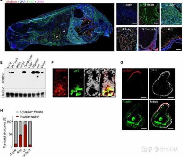 EMBO J | 新发现！circRNA可以调控肠道干细胞的自我更新 - 知乎