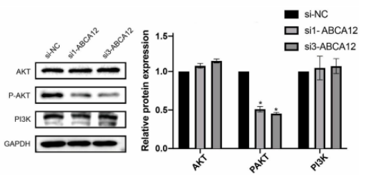【文献解读】ABCA12敲除或可配合靶向药进行胰腺癌治疗 - 知乎