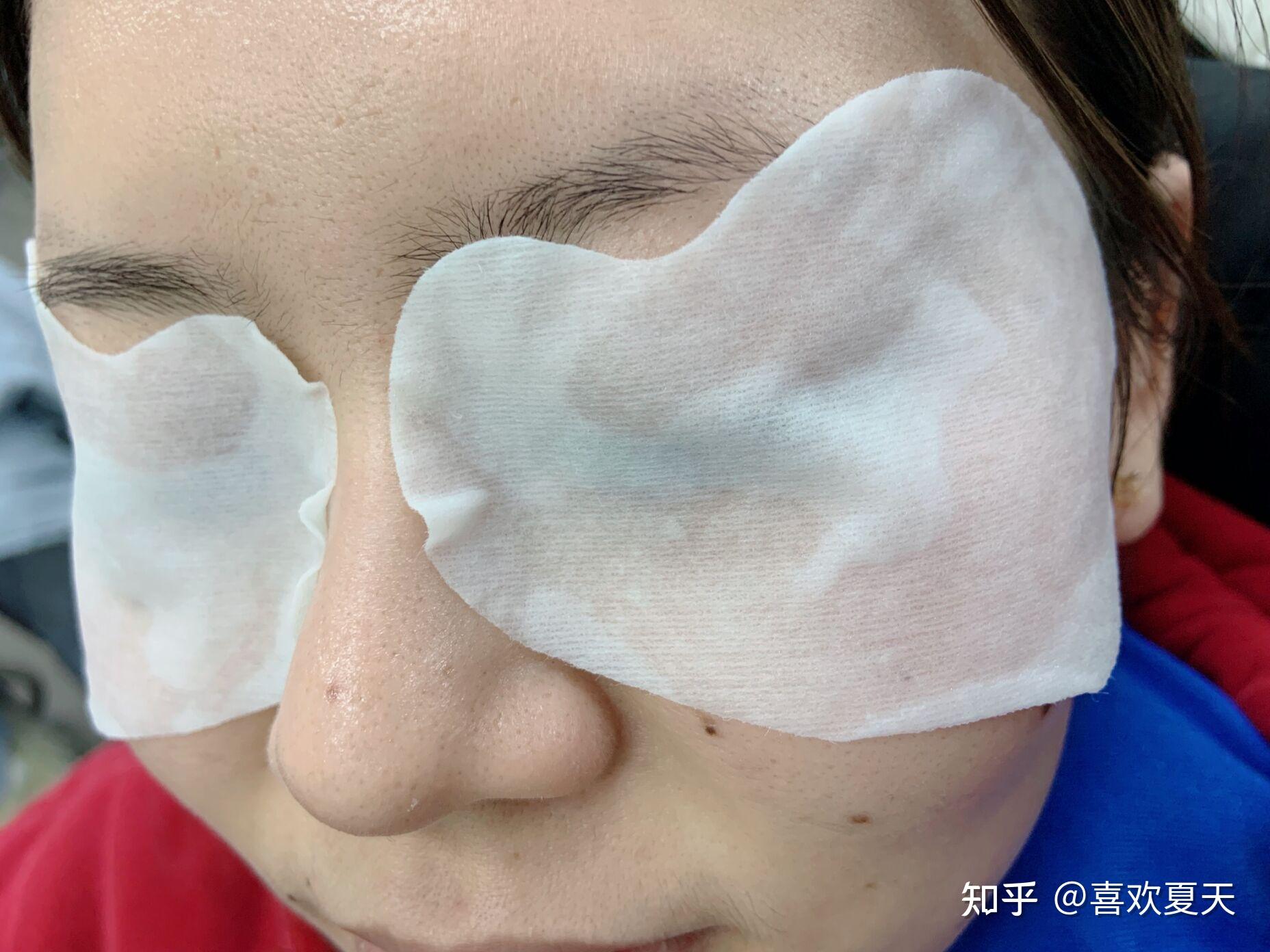 请大数据把这个SOSK倍清亮护眼贴推给要缓解眼疲劳的的近视眼打工人! - 知乎