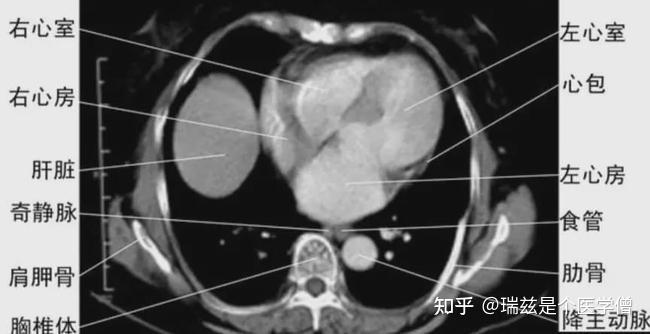CT报告怎么看？3分钟教你读懂！ - 知乎