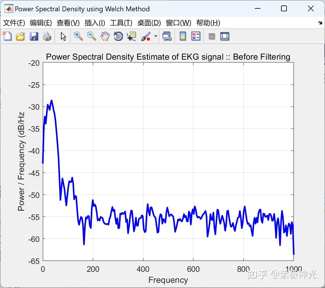 IIR Matlab IIR Matlab