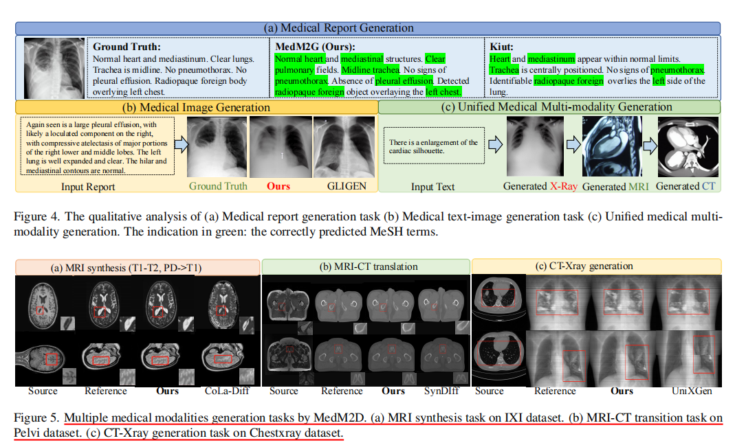 MedM2G: Unifying Medical Multi-Modal Generation via Cross-Guided ...