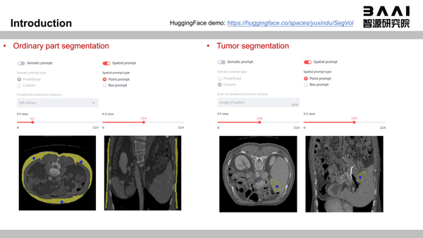 SegVol Web Tool已上线！无需配置，分割一切CT器官、组织 - 知乎