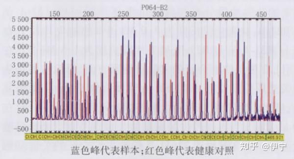 染色体22q11区域基因组疾病的故事 - 知乎