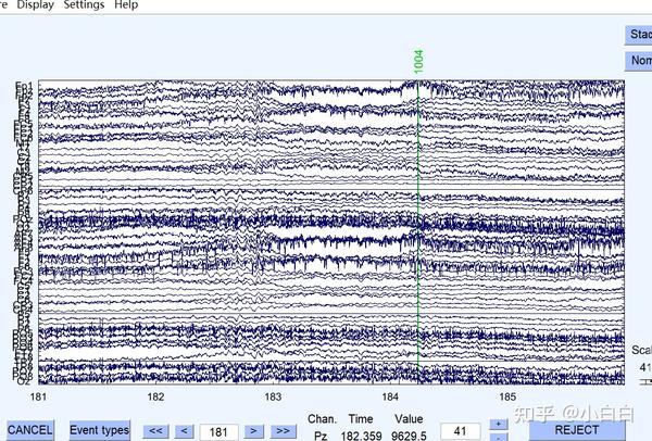 用EEGlab在EEG数据中手动插入事件Marker代码 - 知乎