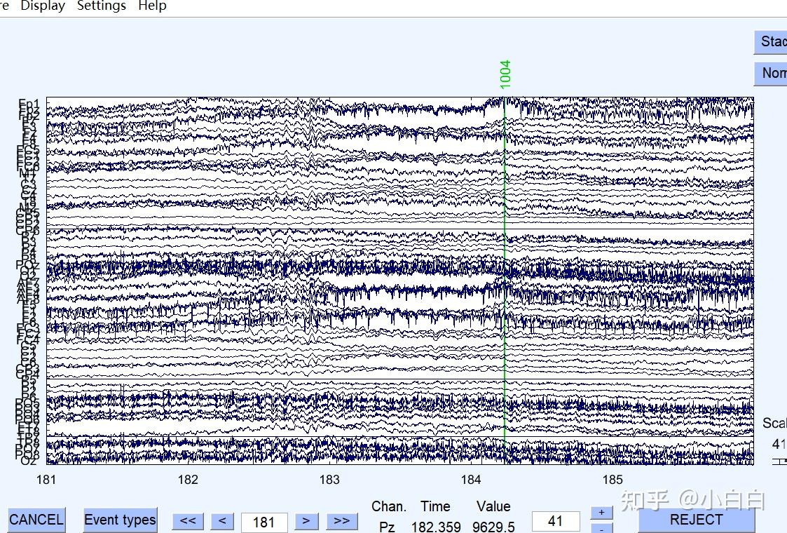 用EEGlab在EEG数据中手动插入事件Marker代码 - 知乎
