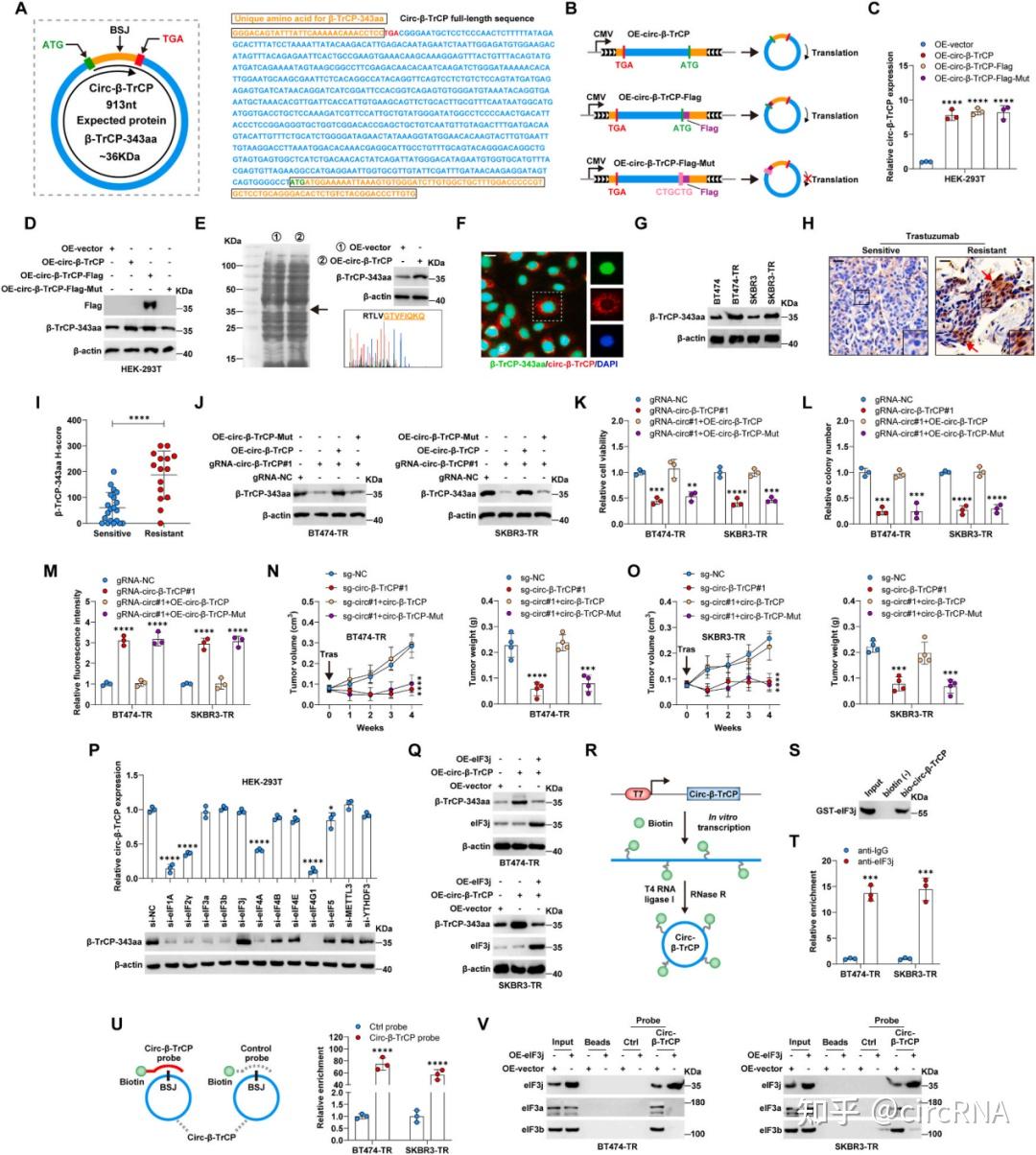Redox Biol丨研究人员揭示环状RNA中潜藏的新型 β-TrCP 蛋白异构体赋予 HER2 乳腺癌患者曲妥珠单抗耐药性 - 知乎