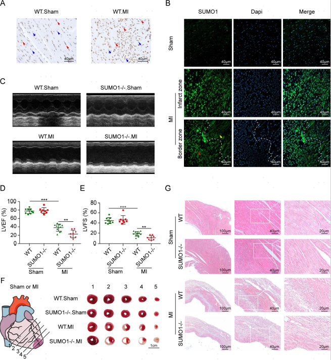 项目文章 | 单细胞测序揭示SUMO1调控心肌梗死后的心脏修复机制 - 知乎