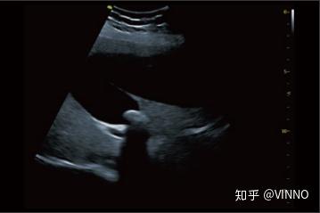 新年首发|VINNO Q系列产品大片全新登场 - 知乎