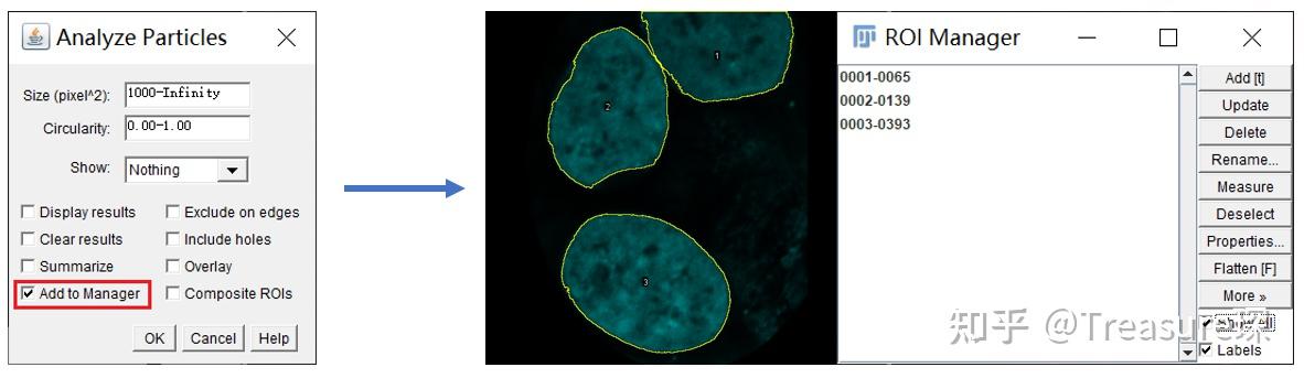 ImageJ实用教程——细胞内荧光点计数(案例分析篇) - 知乎