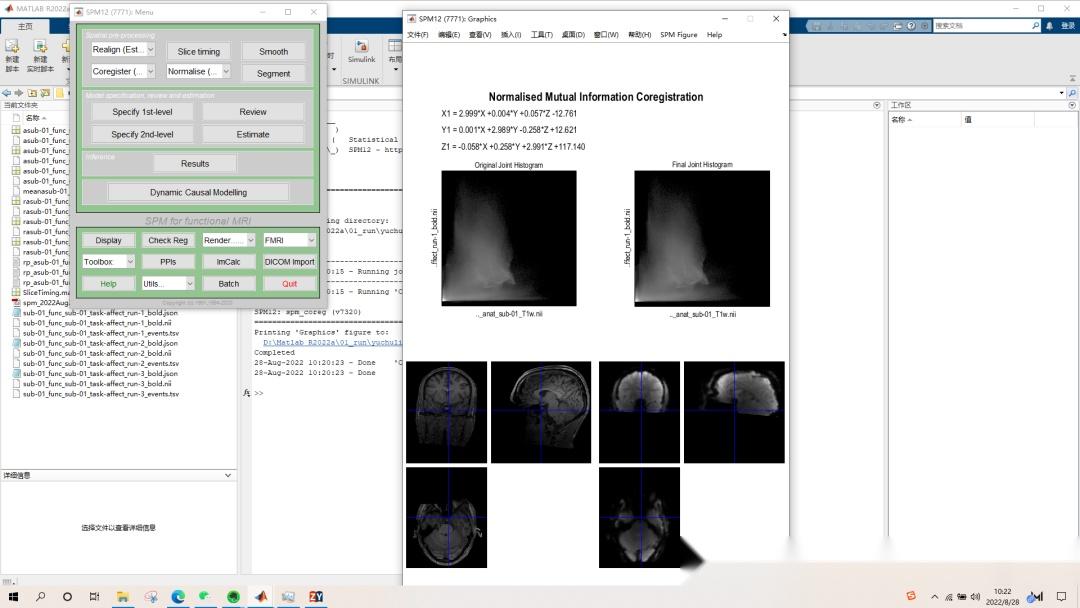 如何用SPM完成fMRI数据的预处理【任务态】 - 知乎
