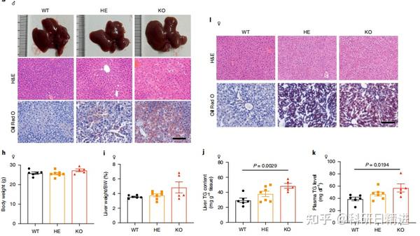 Nature metabolism丨肝脏因子ORM2通过抑制脂肪从头生成维持肝脏脂质稳态 - 知乎