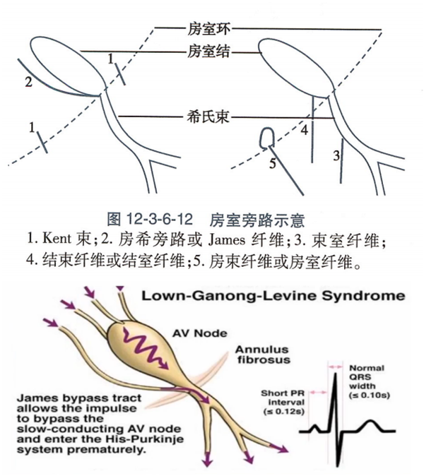 心律失常概述 - 知乎