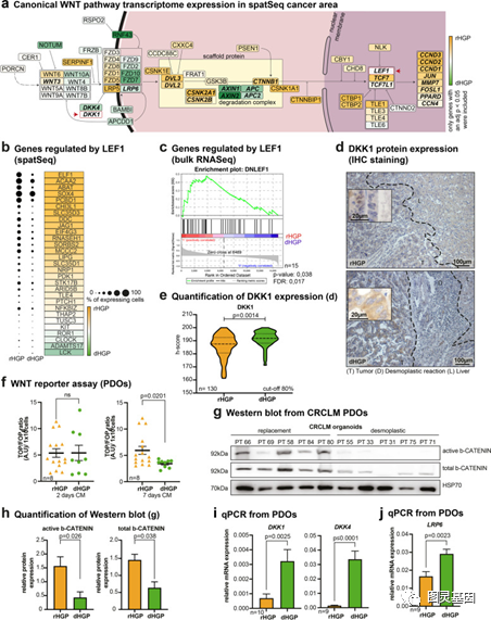 Mol Cancer | 单细胞分辨率下肿瘤不同组织学生长模式(HGP)的分子差异 - 知乎