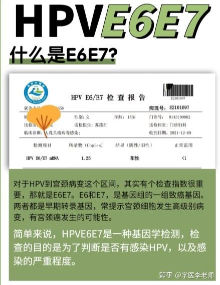 HPV E6E7 报告怎么看一篇讲明白 - 知乎