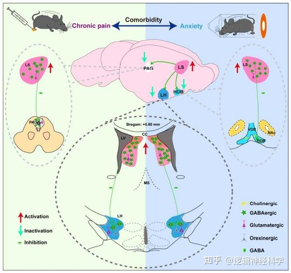 Mol Psychiatry︱杨春/曹君利/刘存明团队揭示外侧隔核向下丘脑外侧区GABA能神经元投射在疼痛和焦虑共病调控中的作用 - 知乎