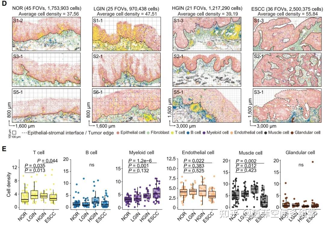 Cancer Cell封面 | 国内首篇Xenium食管癌应用文章亮相 - 知乎
