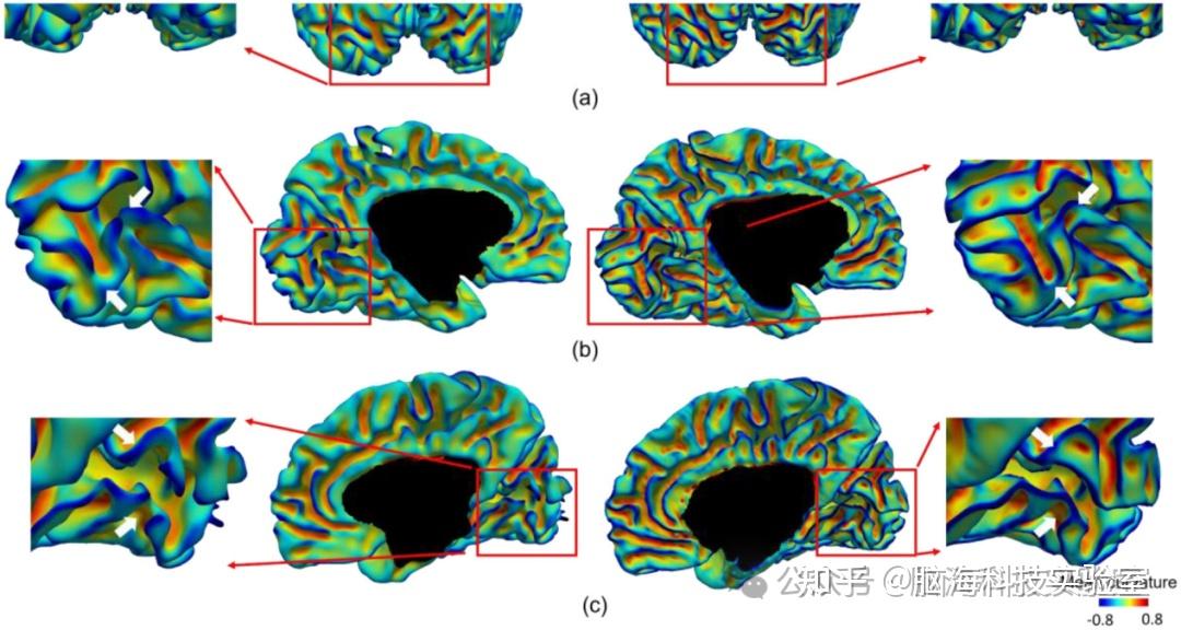 iBEAT V2.0：一个多站点的、基于深度学习的婴儿大脑皮层表面重建Pipeline - 知乎