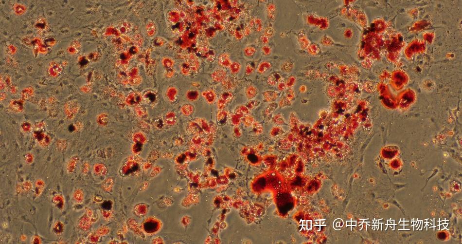 【细胞课堂】3T3-L1细胞培养及成脂诱导分化实验 - 知乎