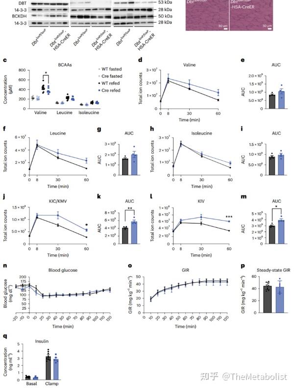 代谢学人--Nature Metabolism：胰岛素敏感性：谁动了我的BCAA？ - 知乎