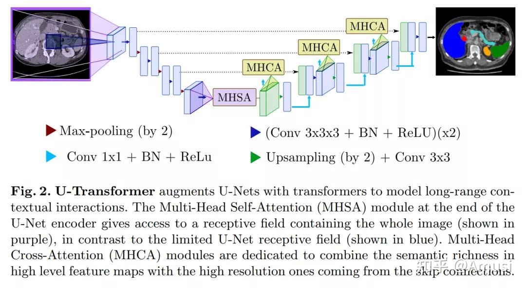 当Transformer遇见U-Net！ - 知乎