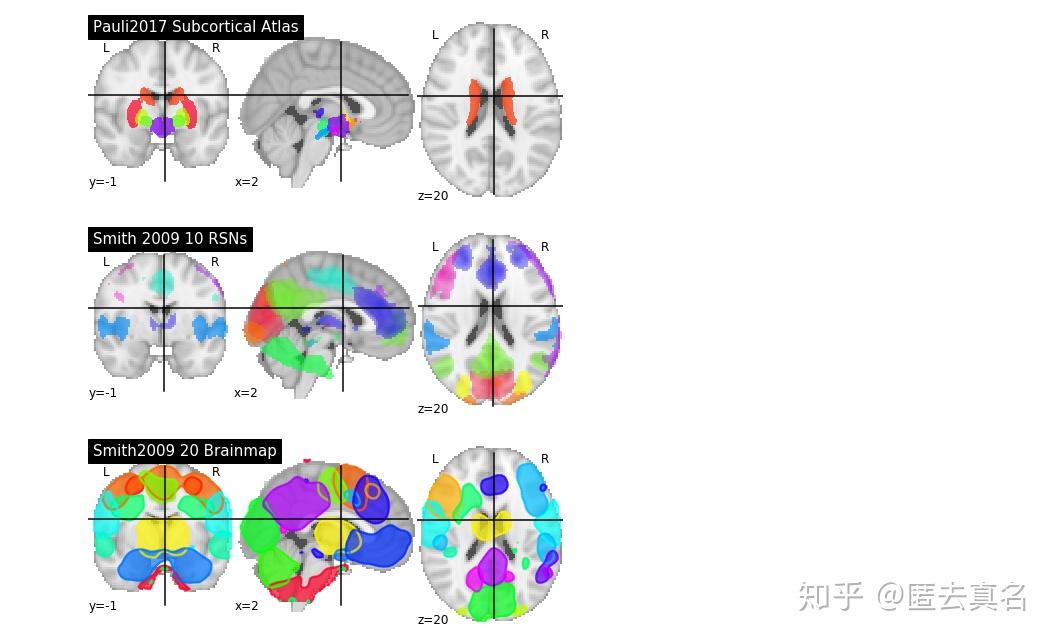 nilearn 笔记（5） - 知乎